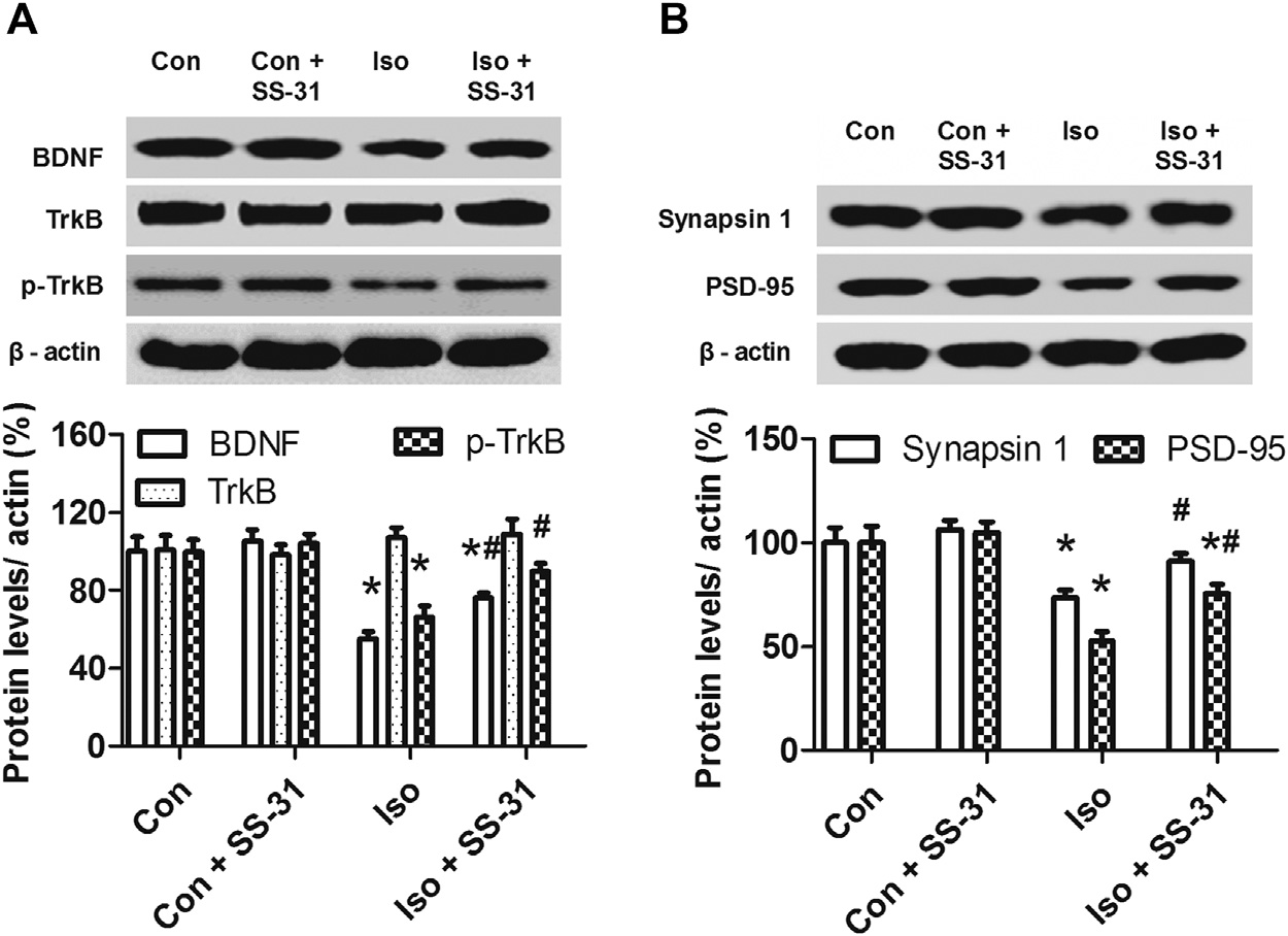SS-31: What Does It Do?