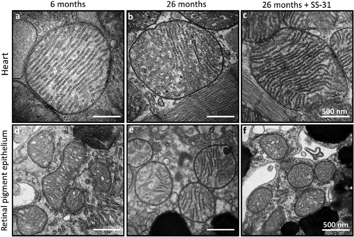 SS-31: What Does It Do?