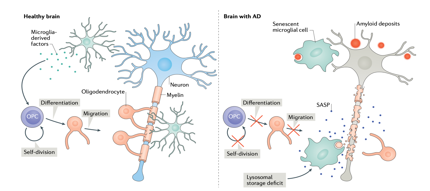 The Role of Senescent Cells in Alzheimer's Disease
