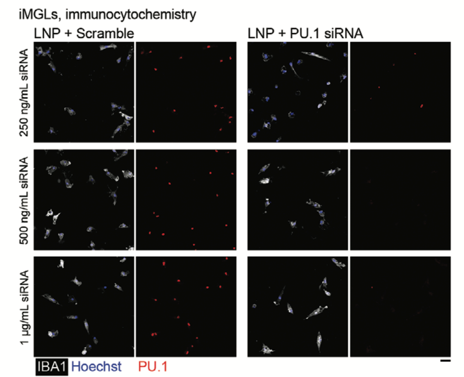 Lipid Nanoparticles Deliver RNA to the Brain for Alzheimer's